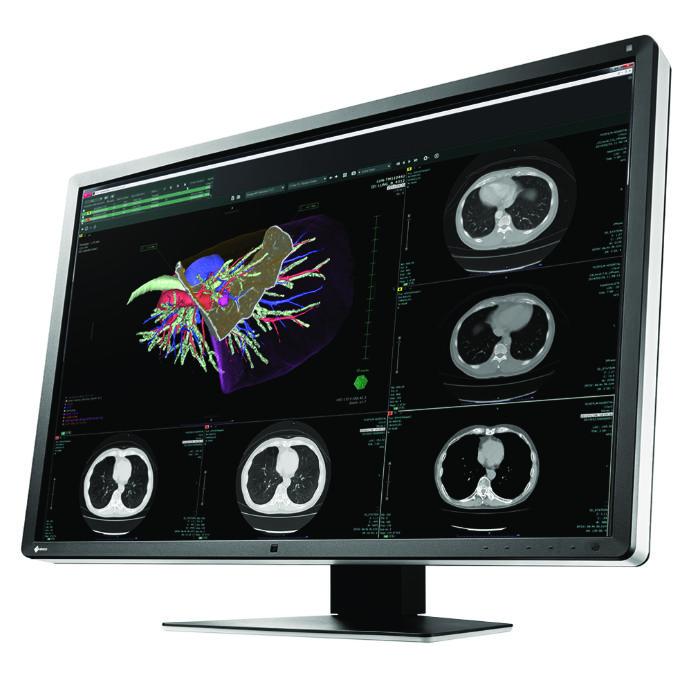 Medical Monitor EIZO RadiForce RX660 6MP Цветен